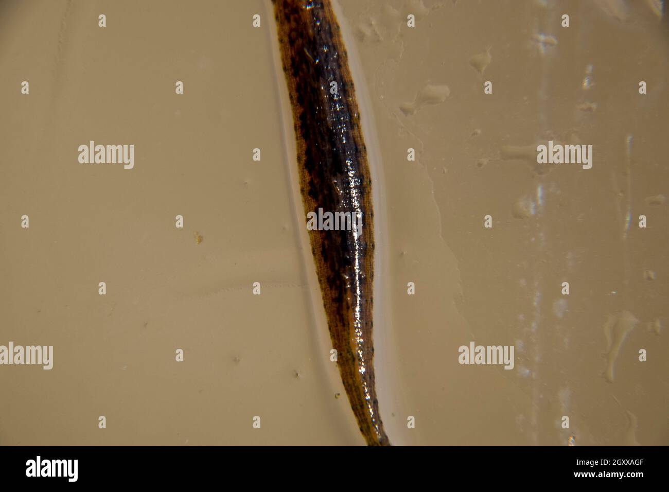 Maladie de la peau avec des morpions Banque de photographies et d ...