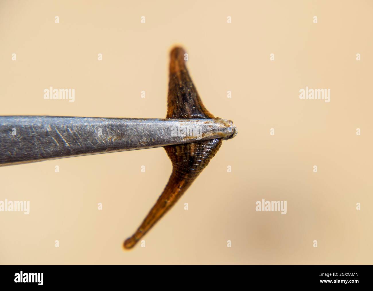 Maladie de la peau avec des morpions Banque de photographies et d ...