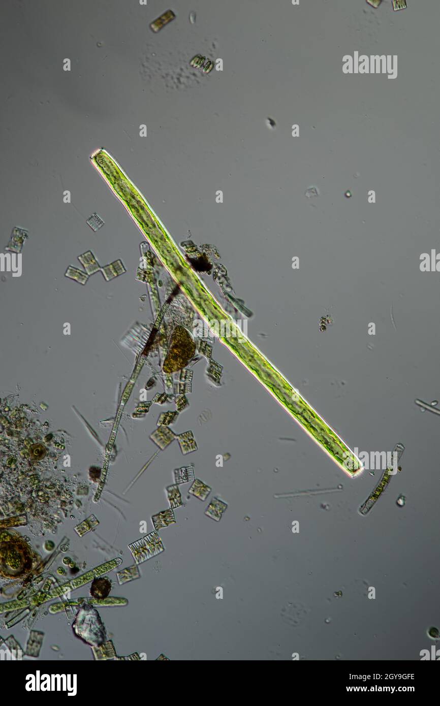 Algues vertes au microscope Banque de photographies et d’images à haute ...