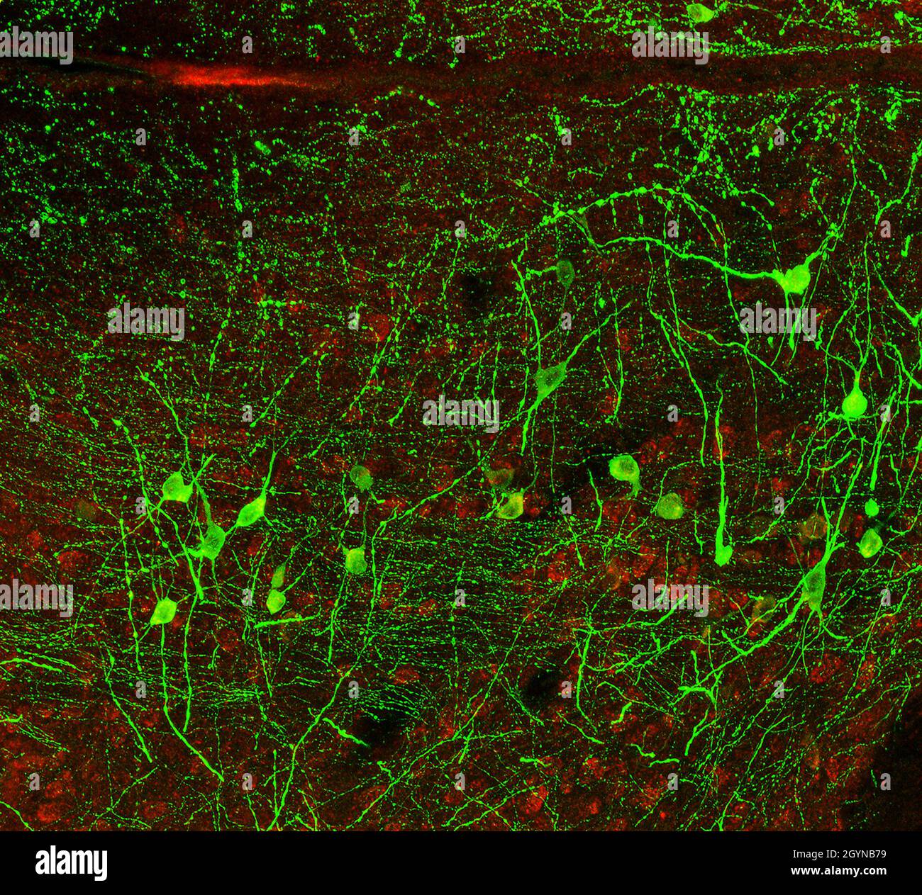 Image confocale en microscopie à balayage laser de cellules marquées ...