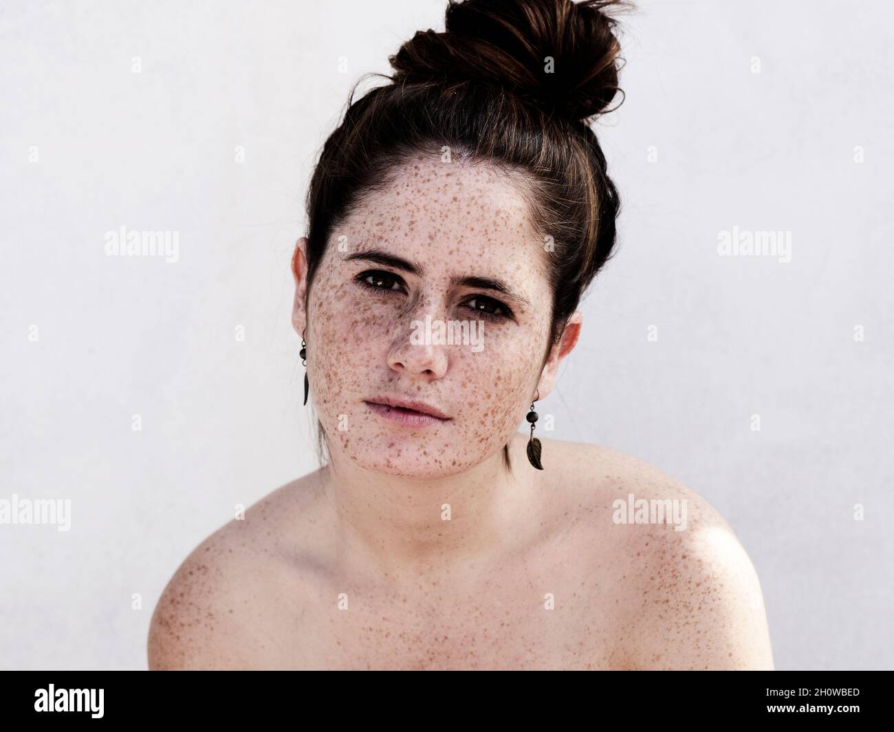 Fille Avec Des Taches De Rousseur Banque De Photographies Et Dimages à