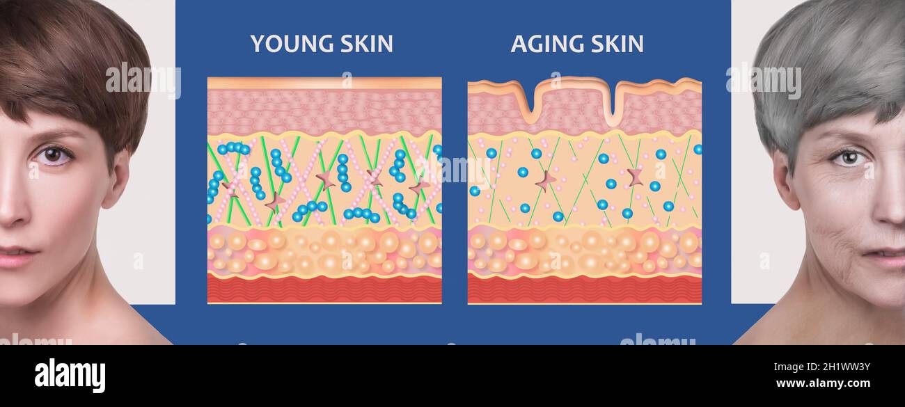 Le schéma d'une peau plus jeune et le vieillissement de la peau montrant la diminution de ...
