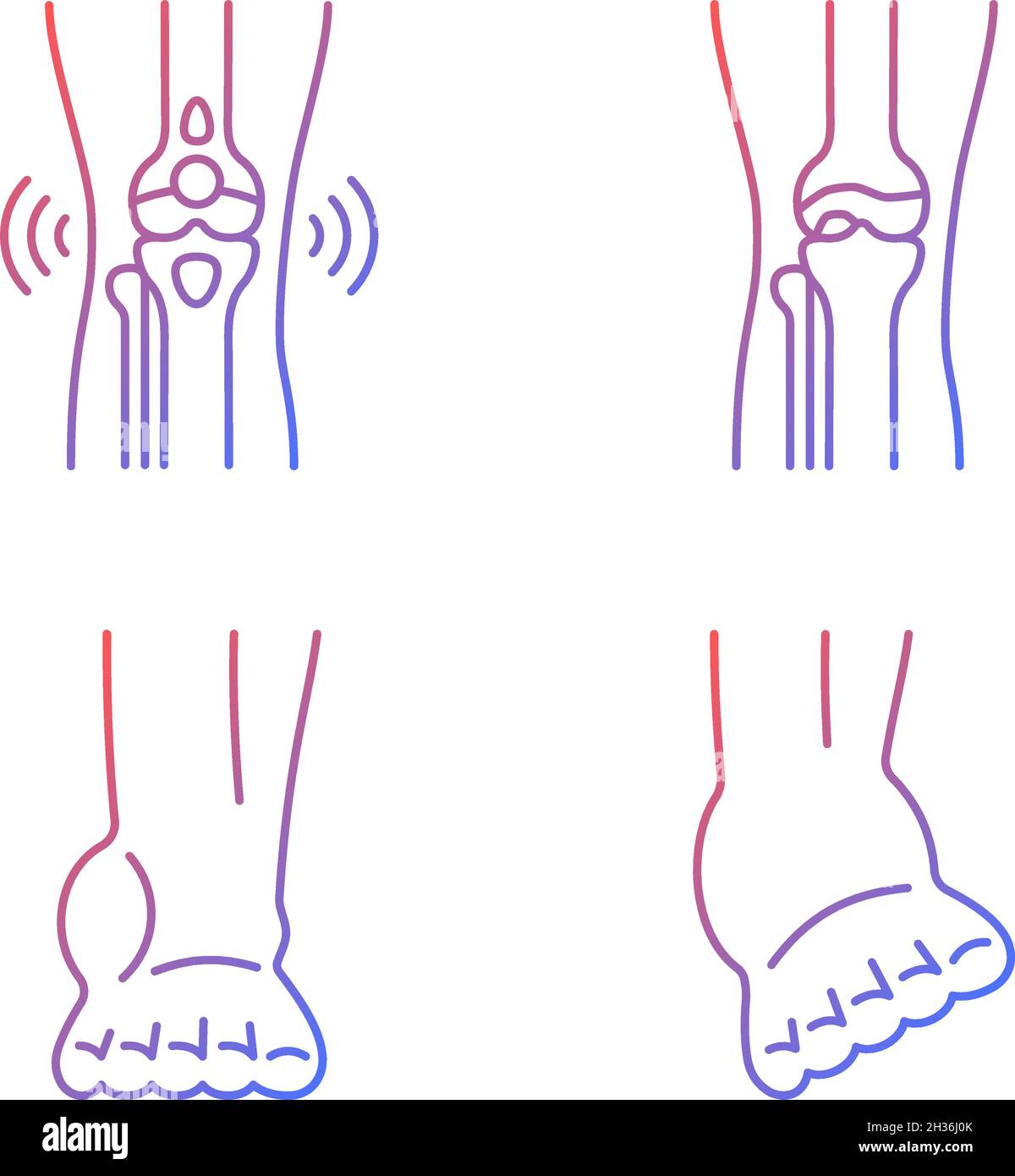 Maladie de la jambe rouge Banque d'images vectorielles - Alamy