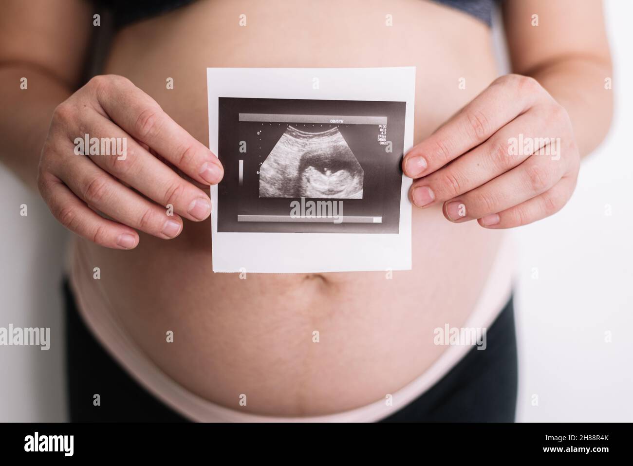 Echographie Abdomen Banque De Photographies Et Dimages à Haute