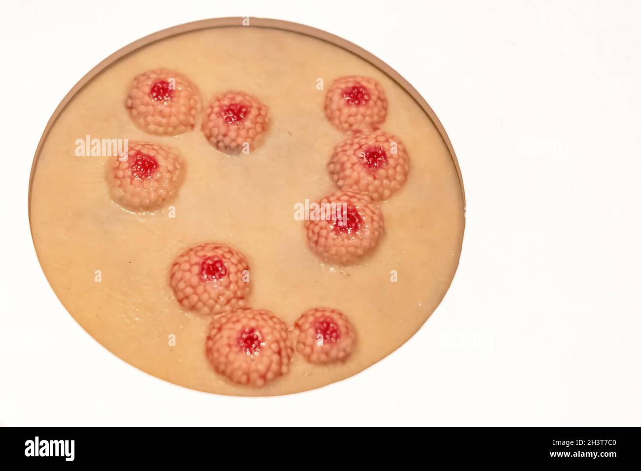 Piqûre de puce Banque de photographies et d’images à haute résolution ...