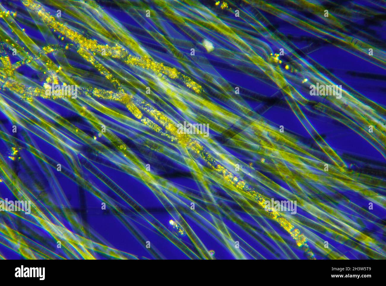 Cyanobacteria microscope Banque de photographies et d’images à haute ...