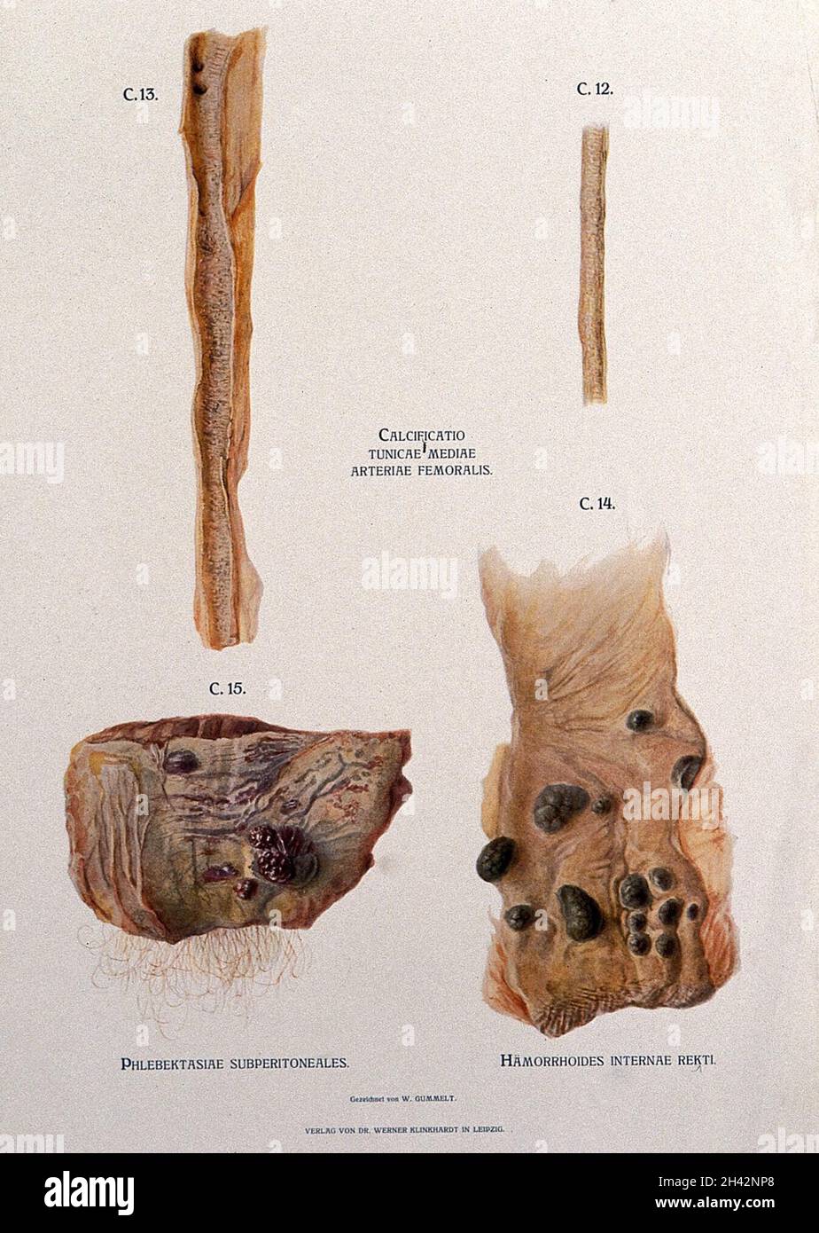 Femoral arteries Banque de photographies et d’images à haute résolution ...