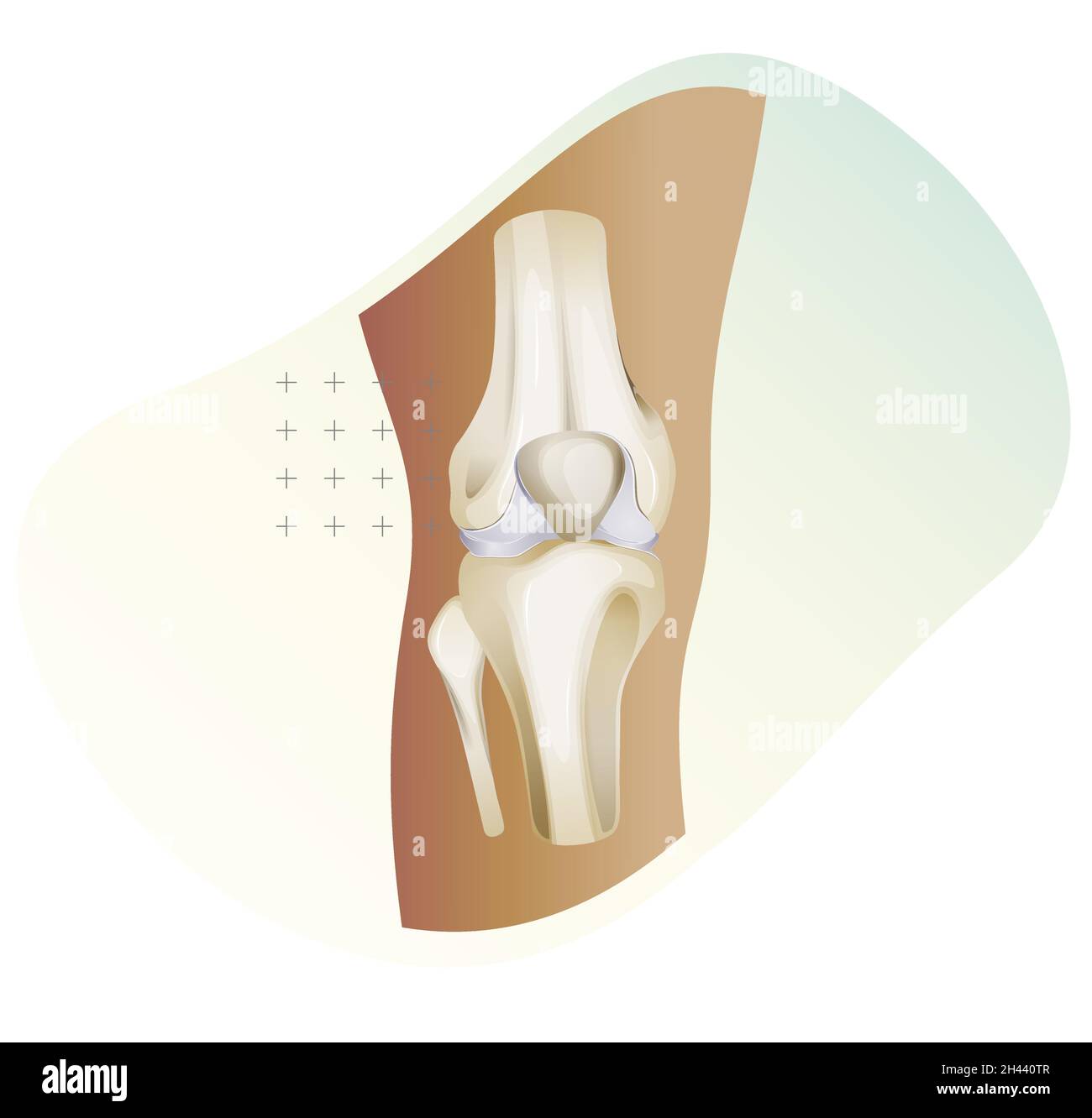 Cartilage injury Banque de photographies et d’images à haute résolution ...