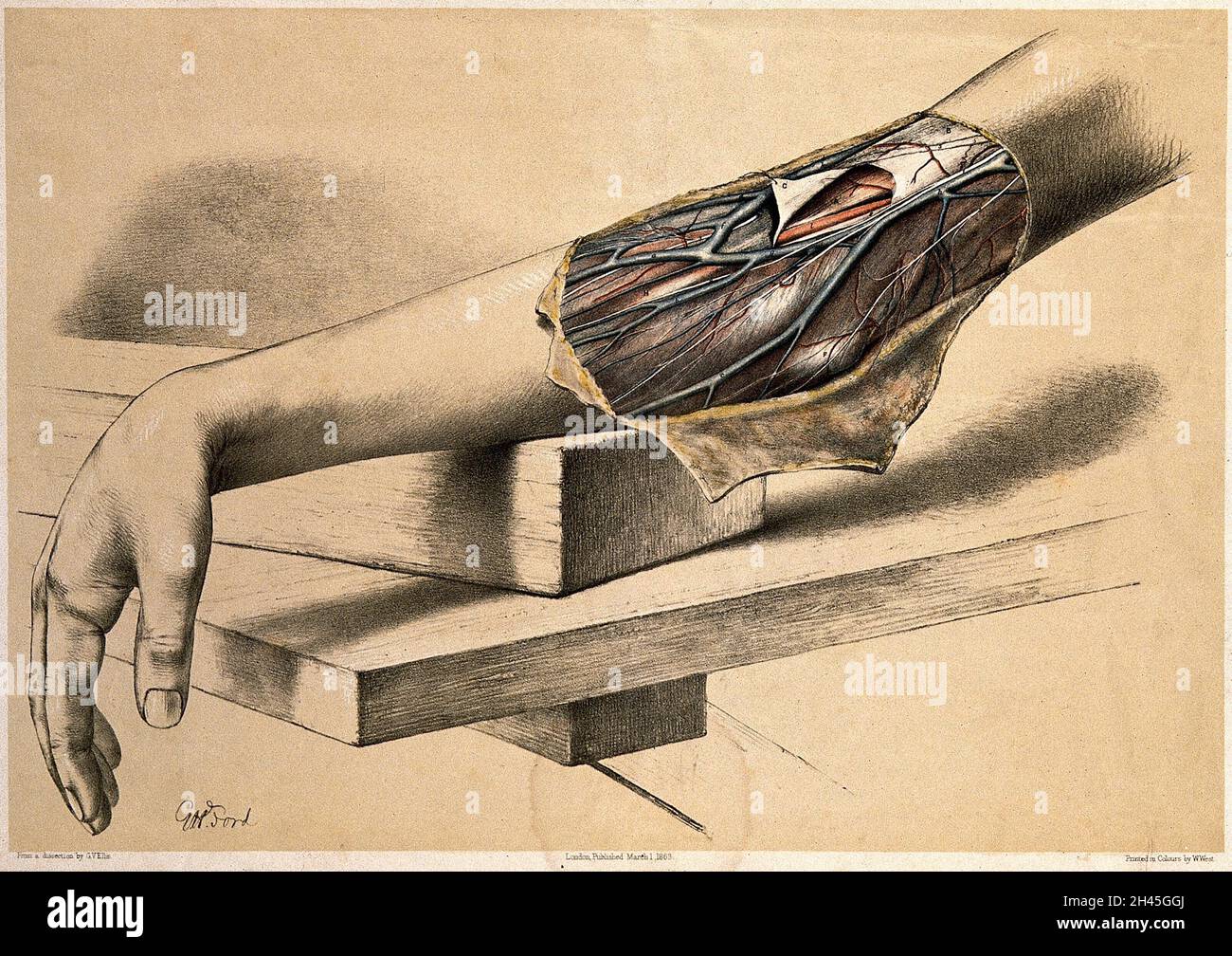 Dissection montrant Banque de photographies et d’images à haute ...