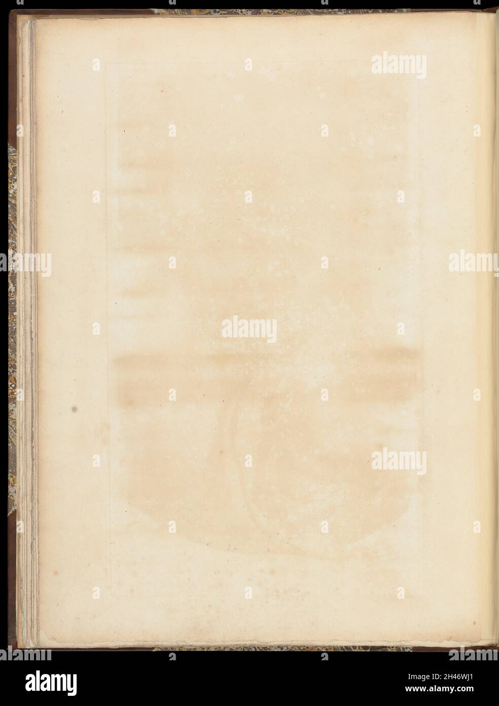 L'anatomie de l'utérus gravide humain est exposée en figures Photo ...