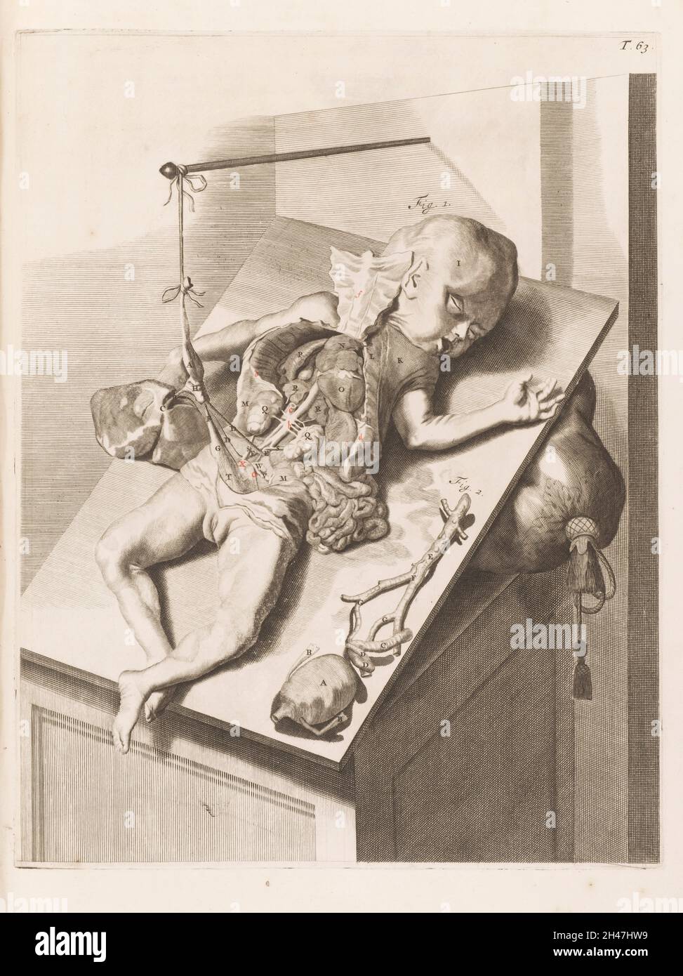 Anatomie abdominale féminine grossesse Banque de photographies et d ...