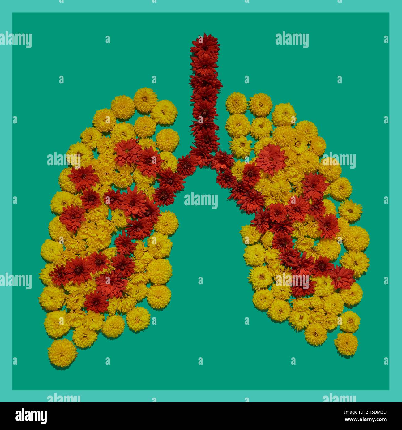Cancer du poumon organes pulmonaires Banque de photographies et d ...