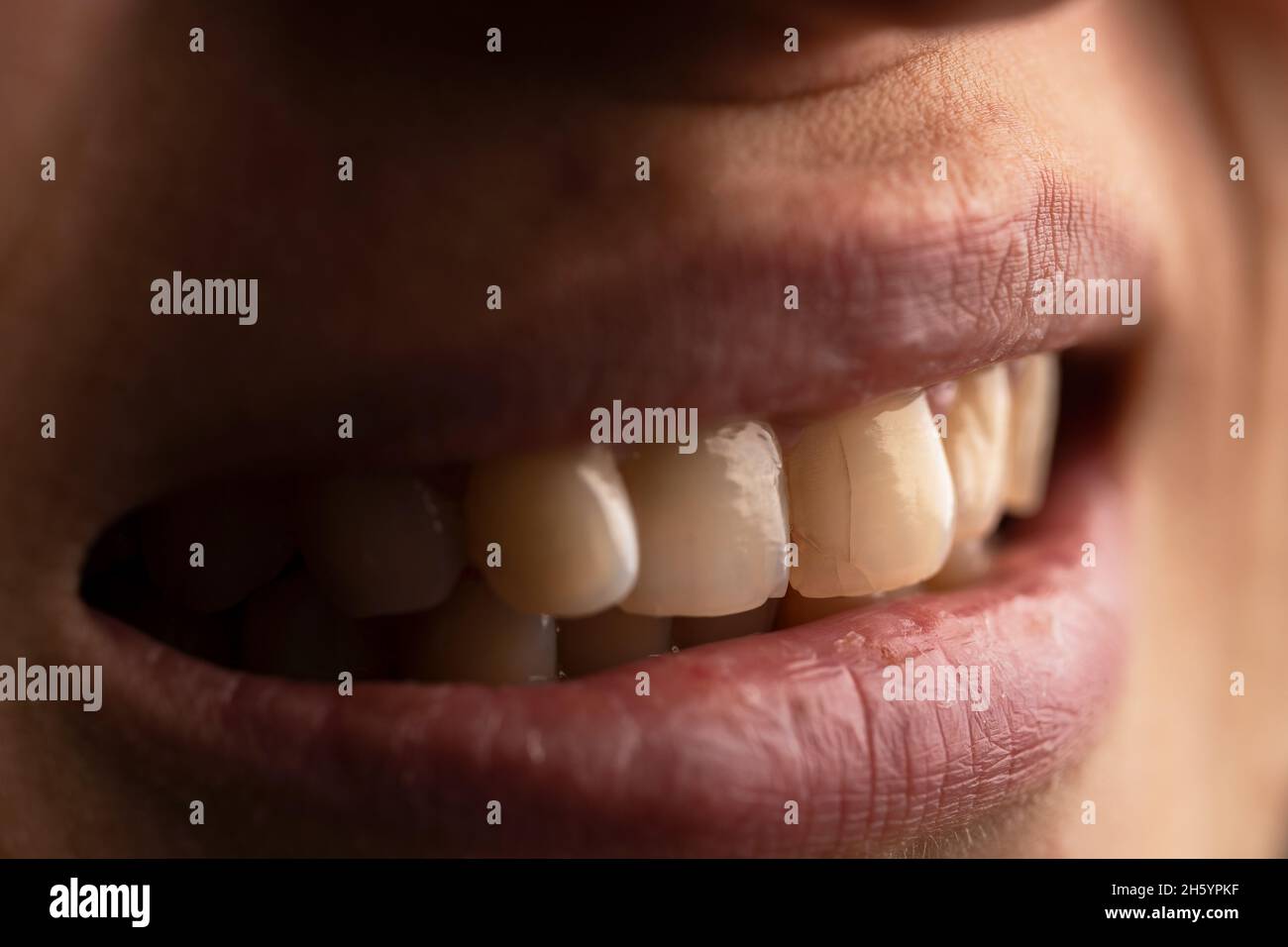 Fracture linéaire Banque de photographies et d’images à haute ...