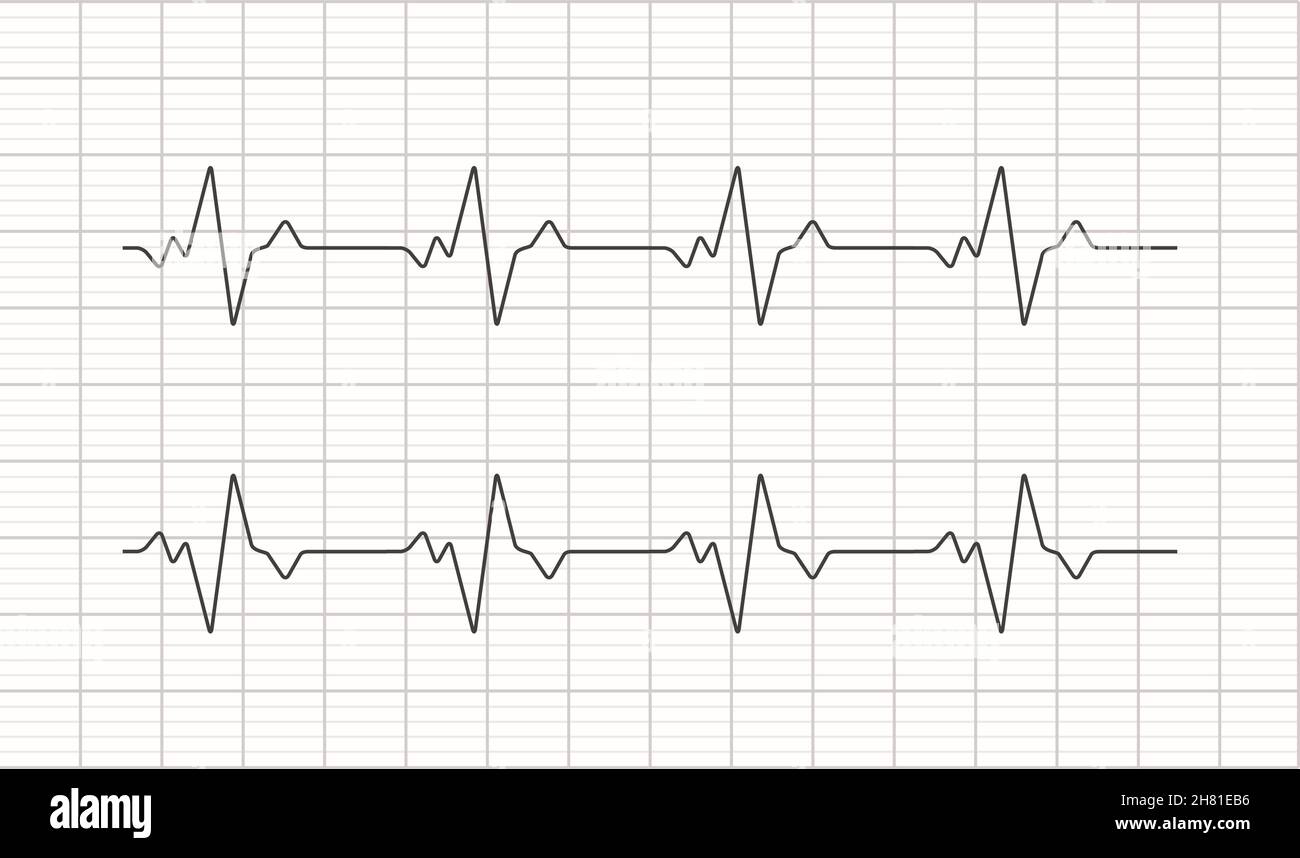 Ligne de tracé du graphique vectoriel de l'électrocardiogramme par ...