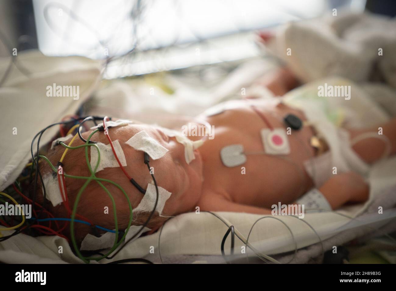 Newborn eeg electroencephalogram Banque de photographies et d’images à ...