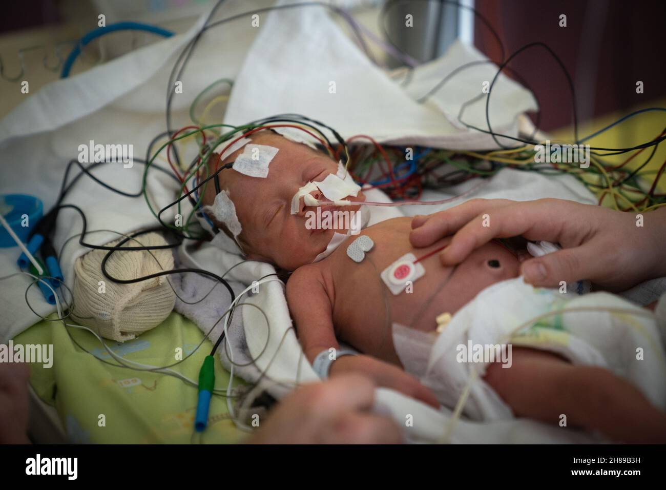 Newborn eeg electroencephalogram Banque de photographies et d’images à ...