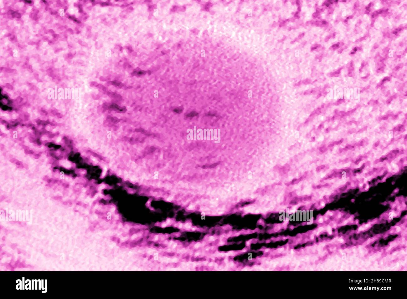 Testicule homme Banque de photographies et d’images à haute résolution ...