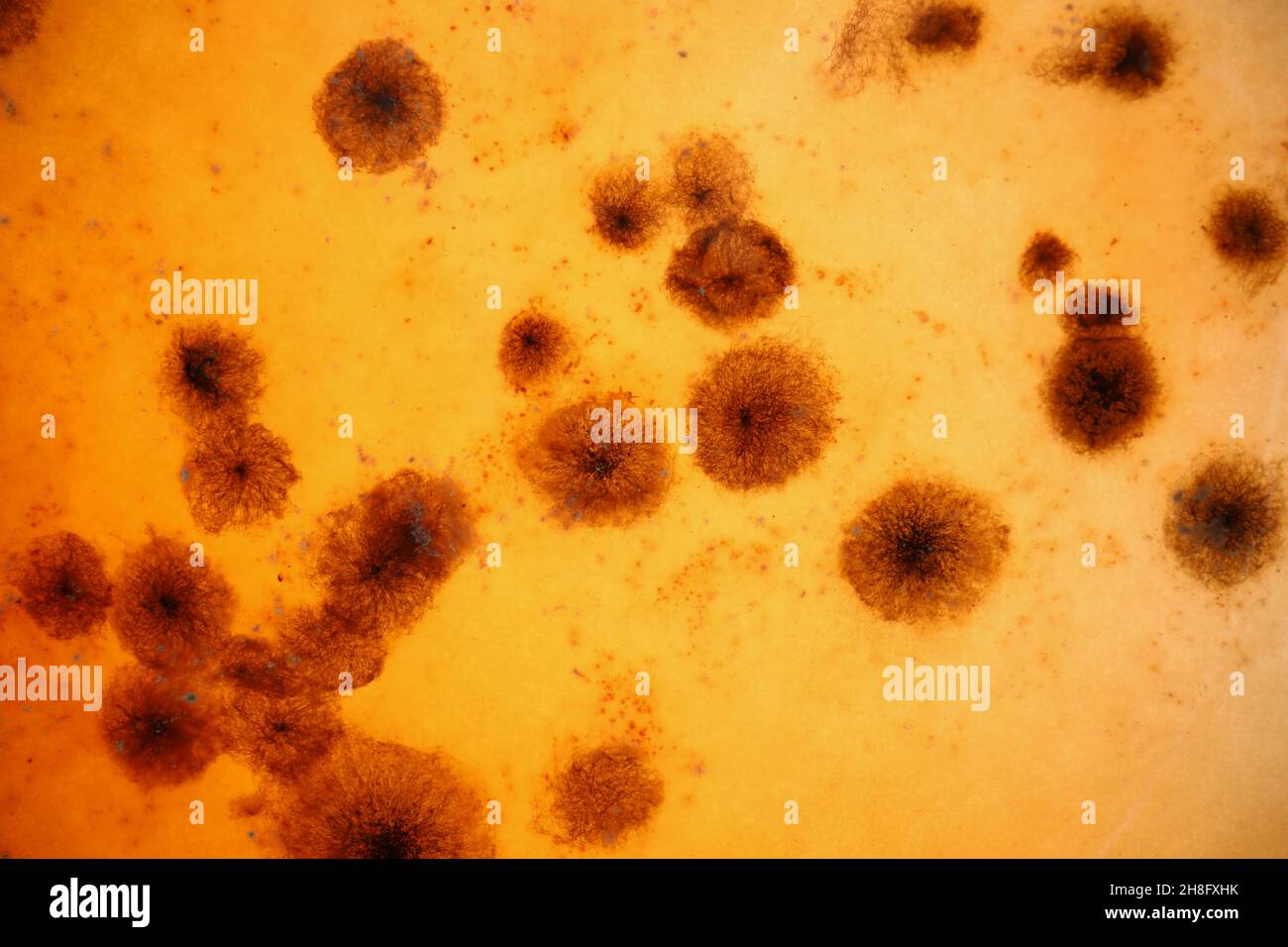 Microbes pathogènes Banque de photographies et d’images à haute ...