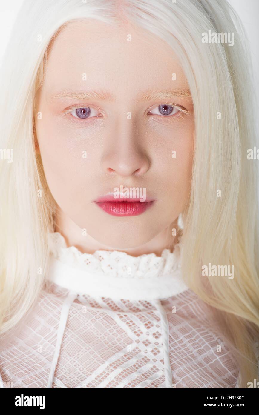 Femme albinos Banque de photographies et d’images à haute résolution ...