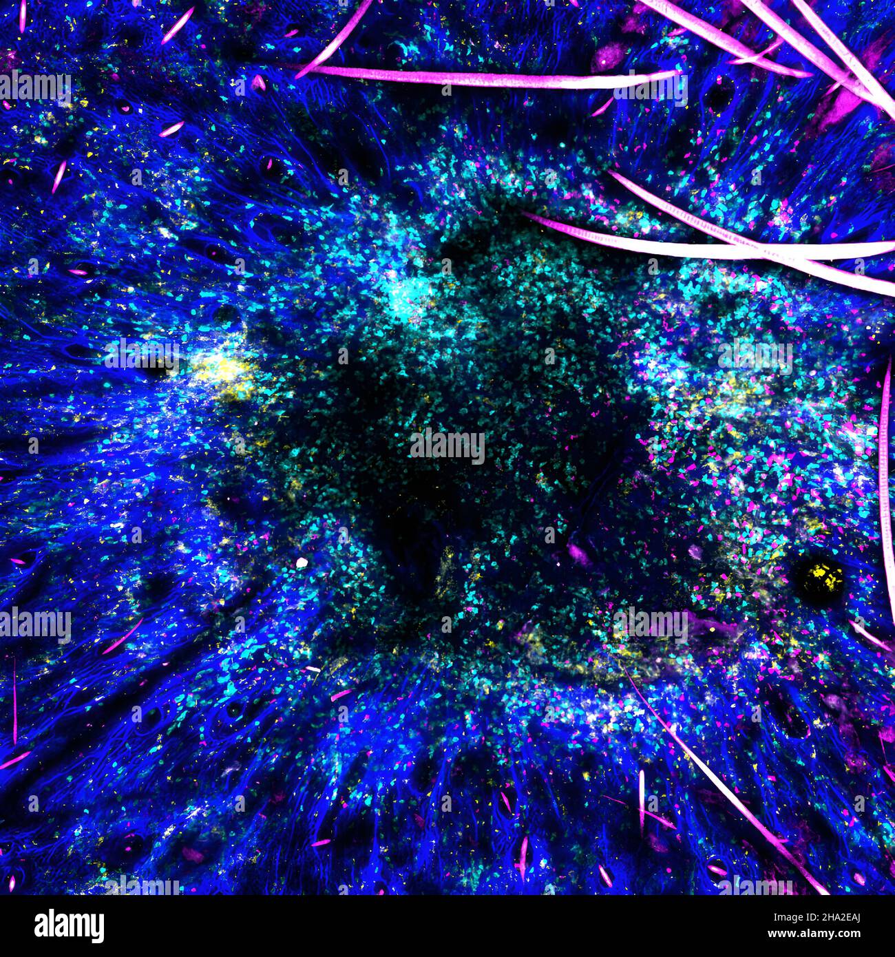 Staphylococcus epidermidis Banque de photographies et d’images à haute ...