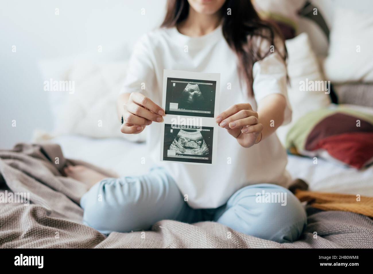Une Femme Enceinte Méconnaissable Porte Une échographie Dun Fœtus