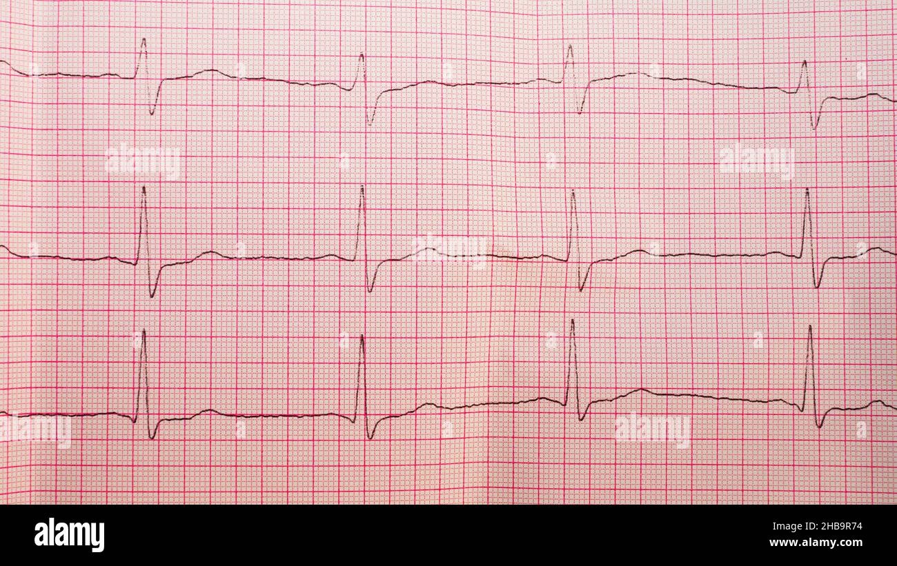 Cardiogramme cardiaque dans les mains d'un médecin.Le médecin analyse ...