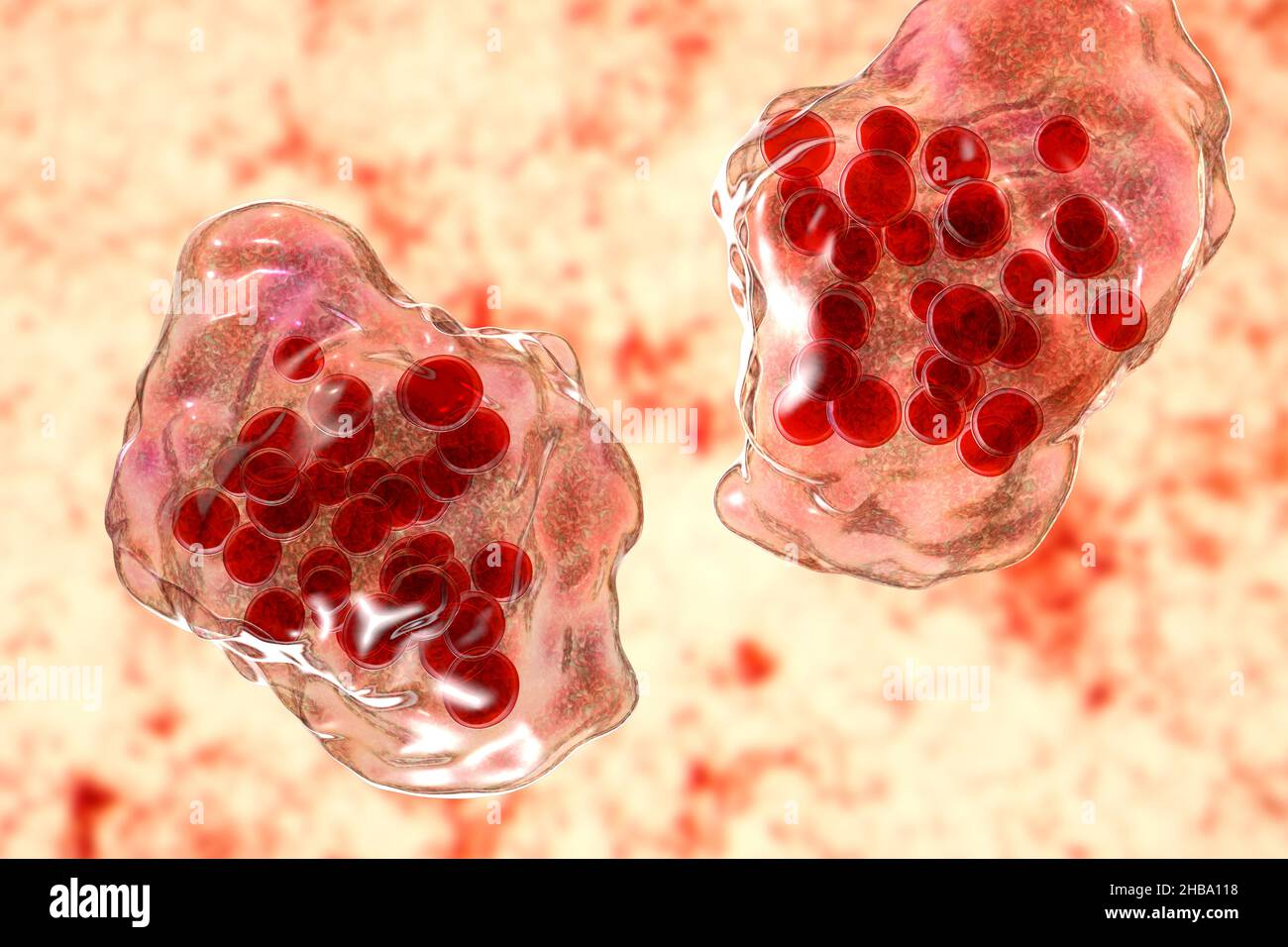 Illustration de l'infection par le virus de la rougeole montrant des ...
