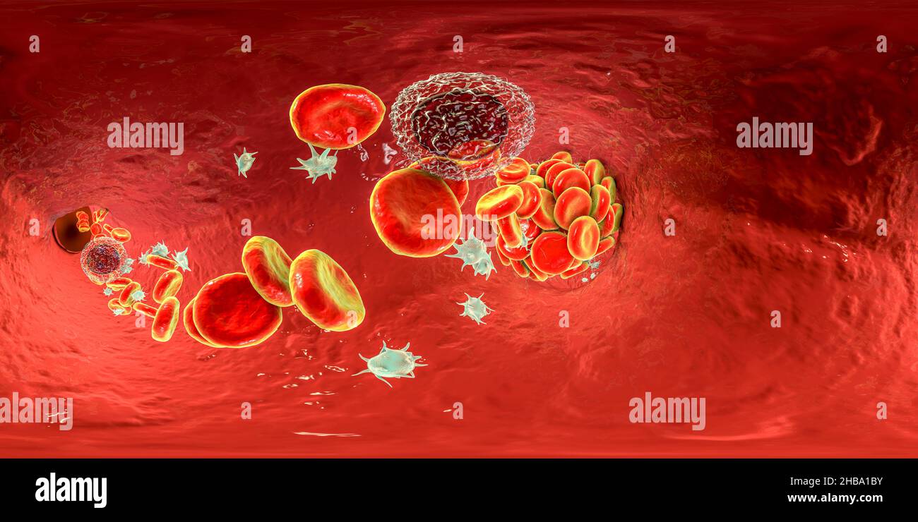 Sang coagulé Banque de photographies et d’images à haute résolution - Alamy