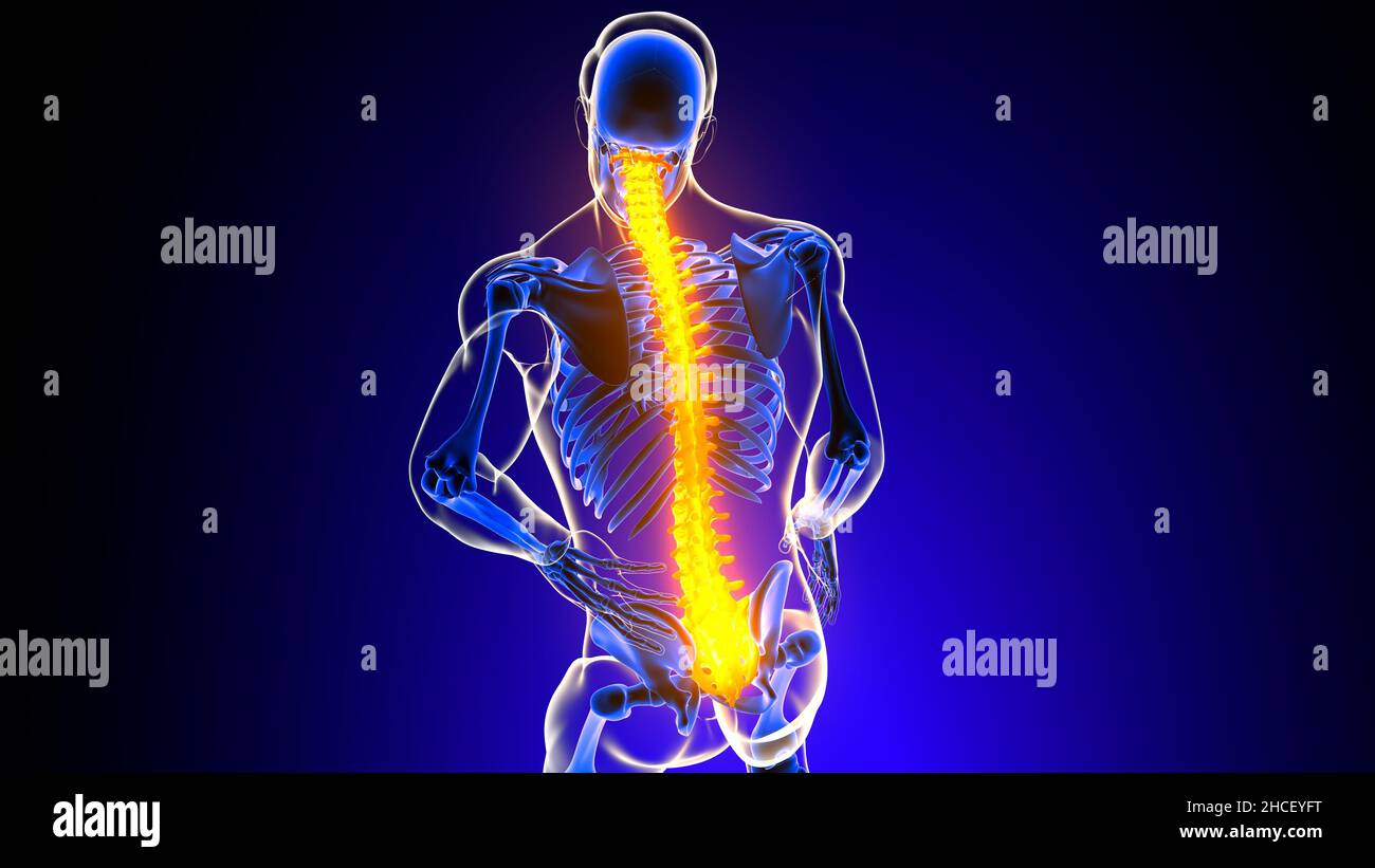 Colonne vertébrale véritable douleur dorsale Anatomie pour le concept ...