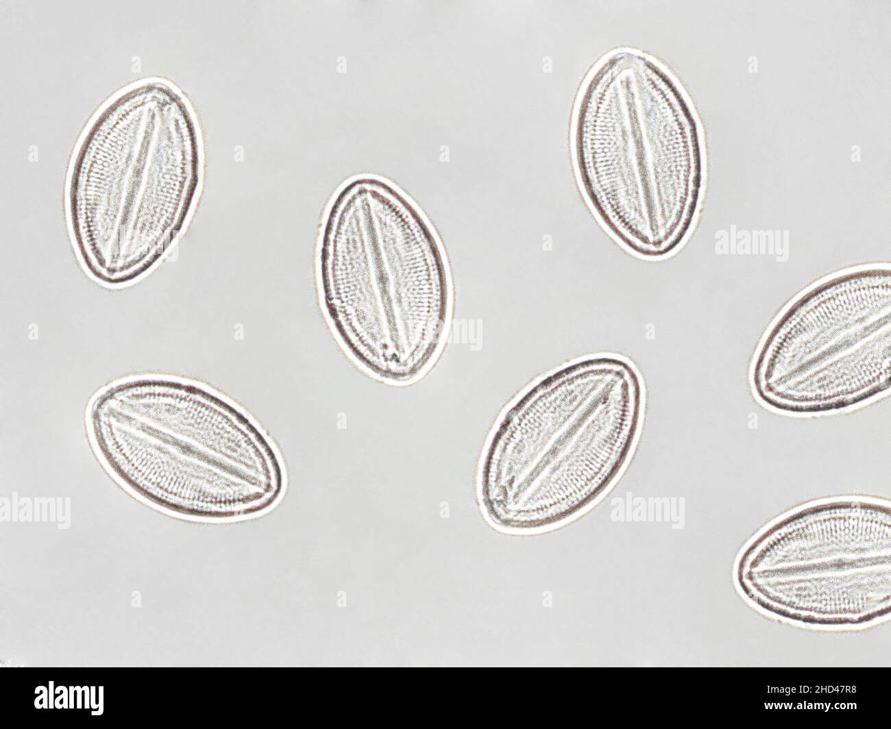 Algues sous une vue microscopique, diatomées, algues vertes, petits ...