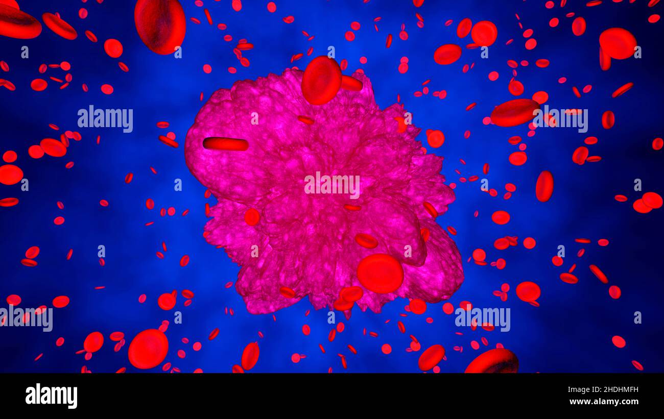 Cancers du sang Banque de photographies et d’images à haute résolution ...
