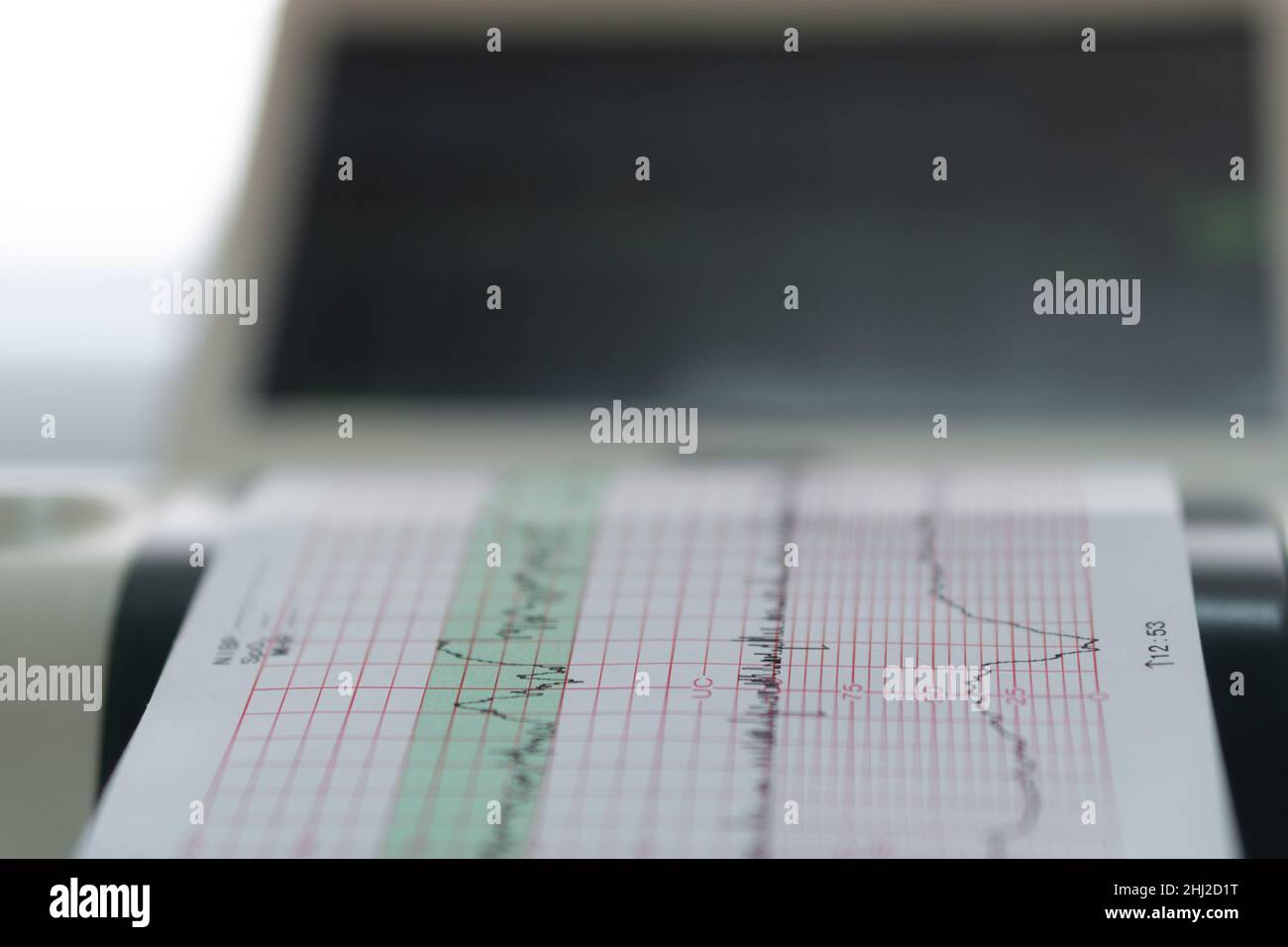 Appareil de cardiotocographie Banque de photographies et d’images à ...