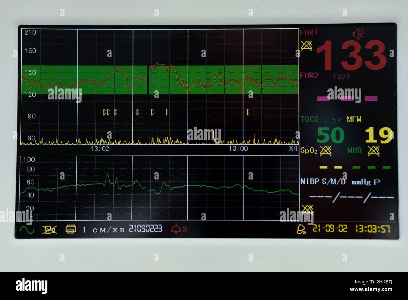 Appareil de cardiographie électronique surveillance des contractions ...