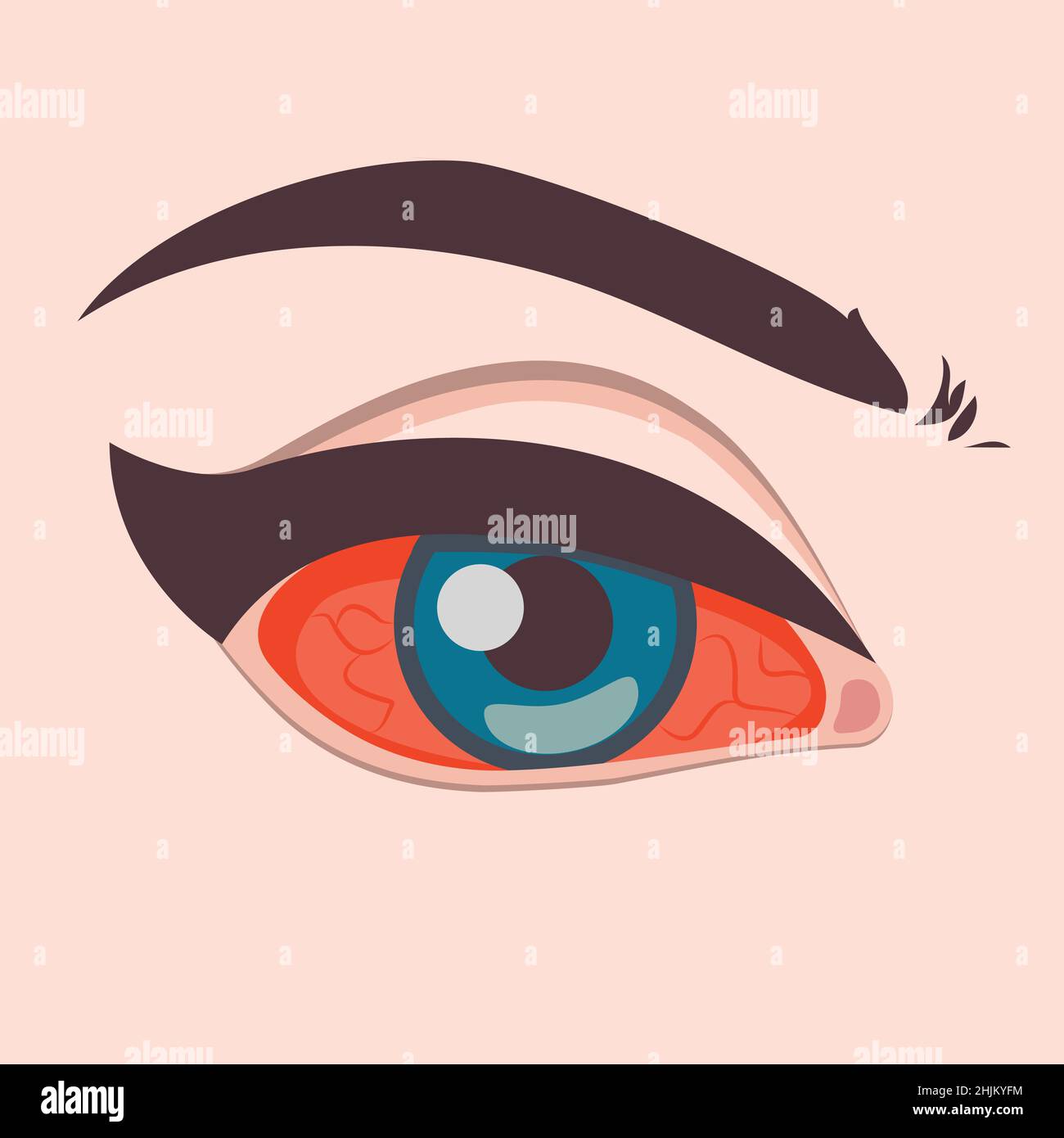 œil injecté de sang yeux Banque d'images vectorielles - Alamy