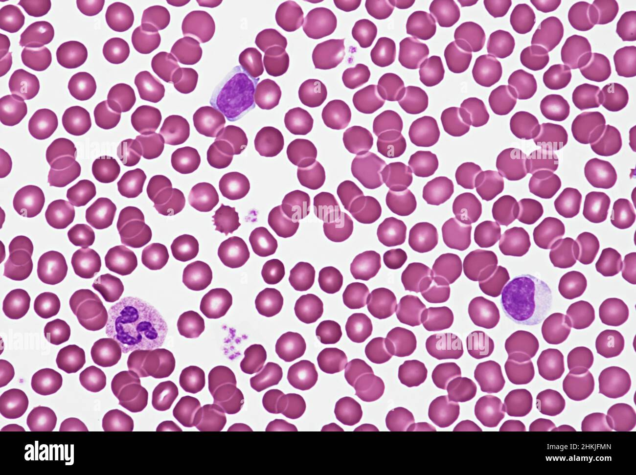 Frottis sanguin, lumière microphotographie Photo Stock - Alamy