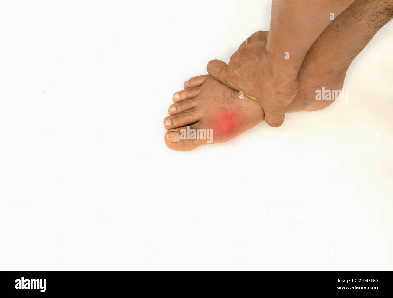 Maladie de la jambe rouge Banque de photographies et d’images à haute ...