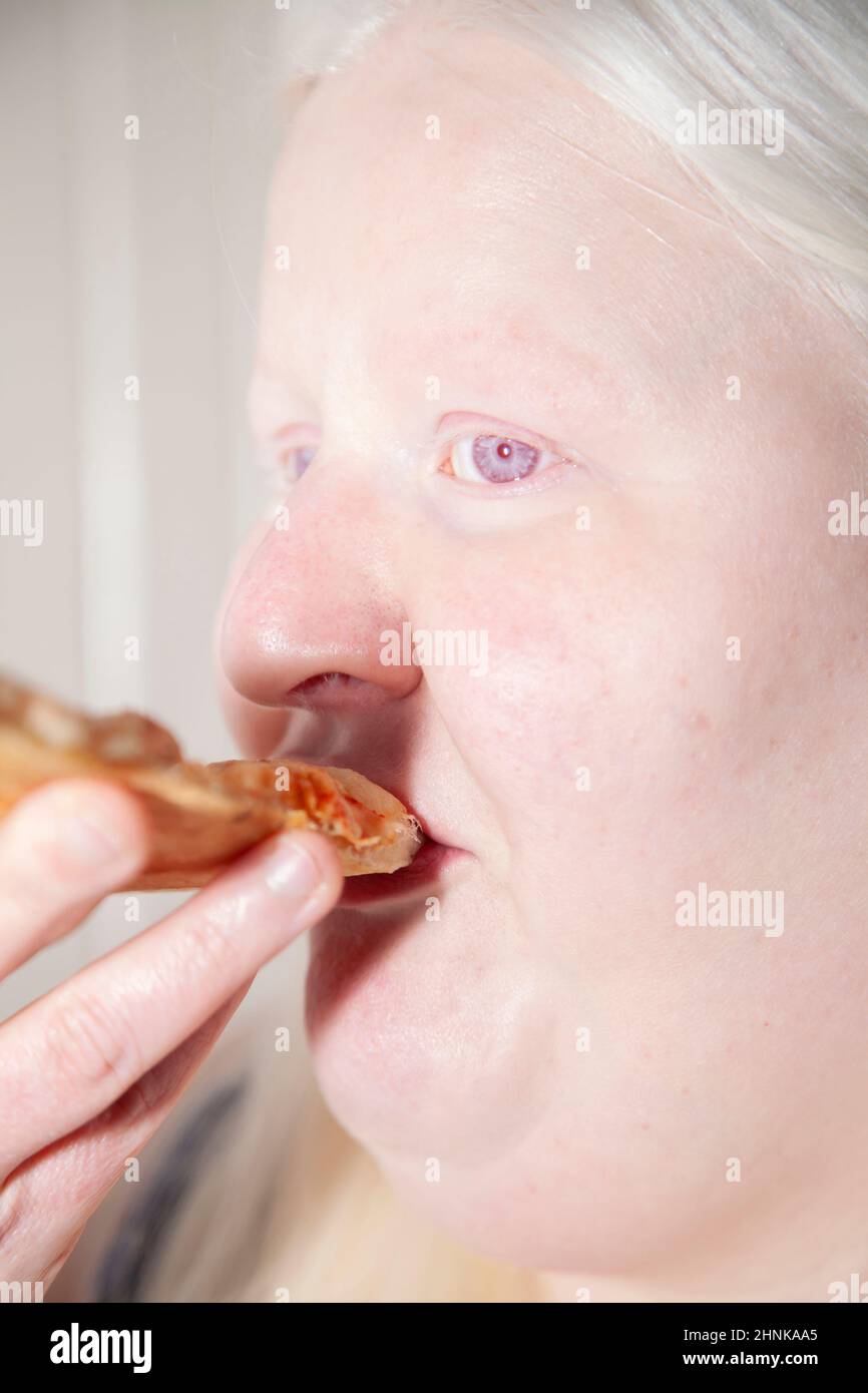 Humain albinos Banque de photographies et d’images à haute résolution ...