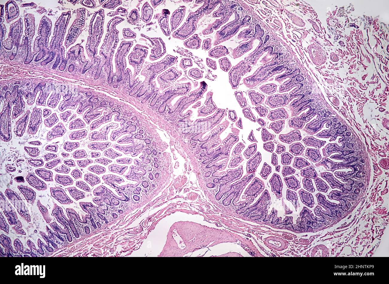 Intestinale dans un microscope Banque de photographies et d’images à ...
