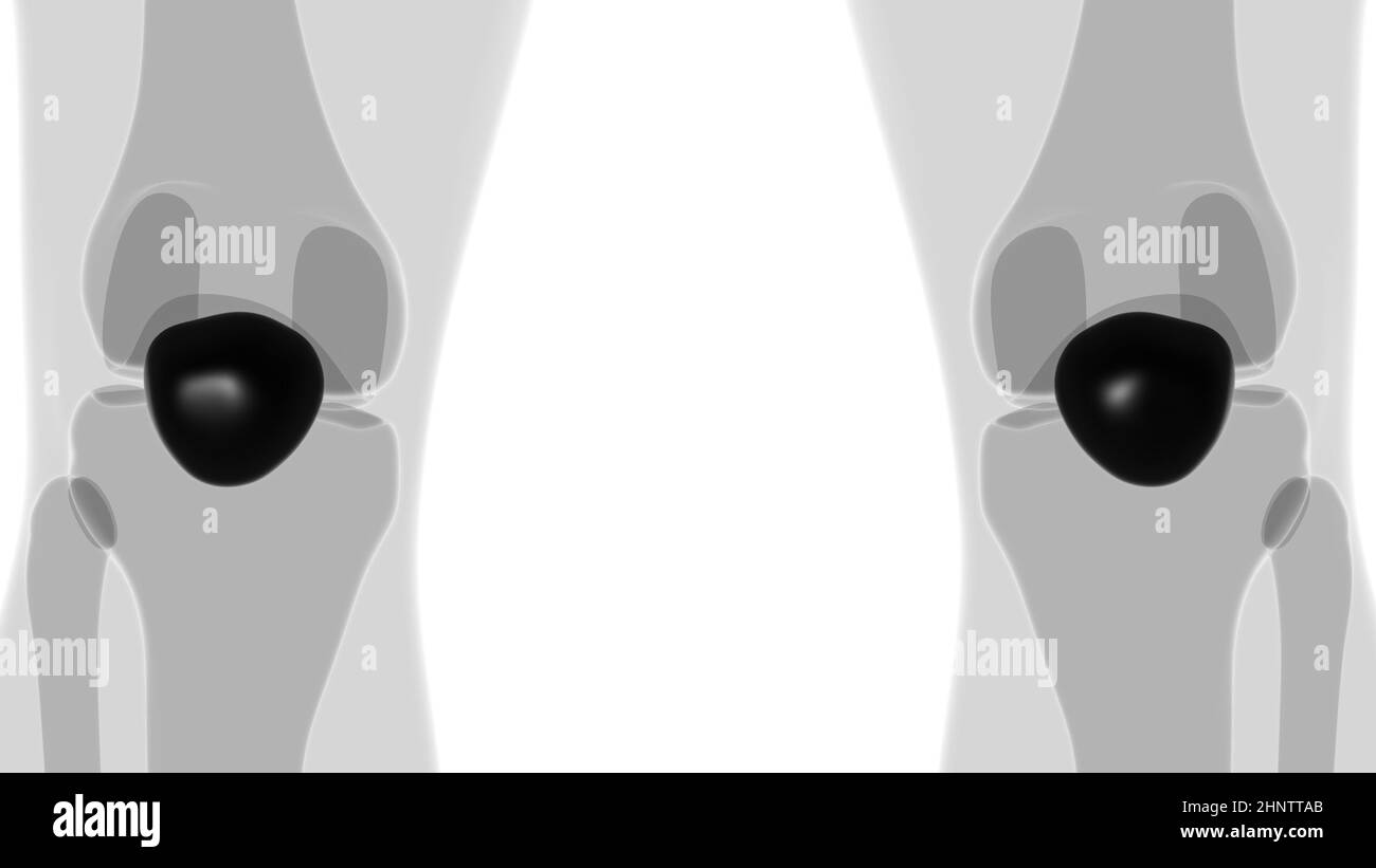 Anatomie du squelette humain rotule OS 3D Rendering for Medical concept ...