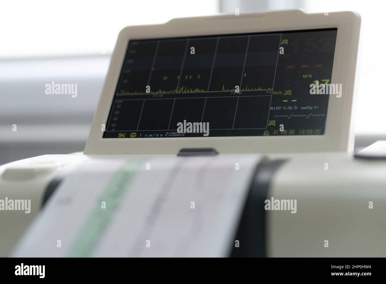 Appareil de cardiographie électronique surveillance des contractions ...