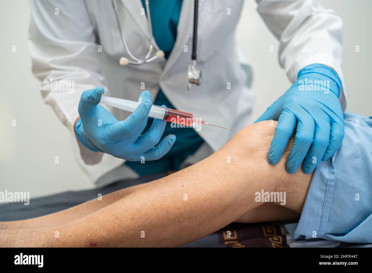 Platelet rich plasma Banque de photographies et d’images à haute ...