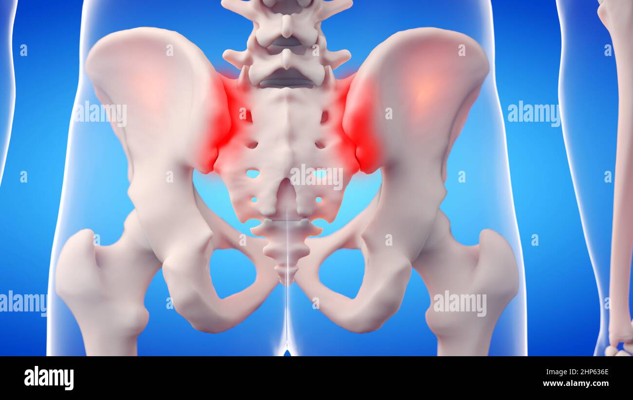 Articulation sacro iliaque douloureuse Banque de photographies et d ...