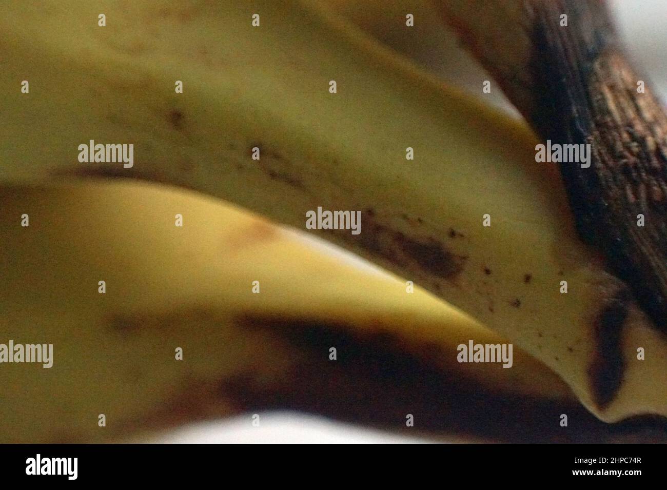 Taches sur la peau Banque de photographies et d’images à haute ...