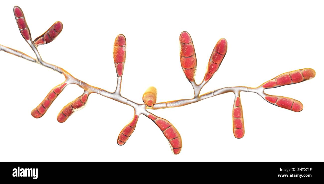 Epidermophyton floccosum Banque de photographies et d’images à haute ...