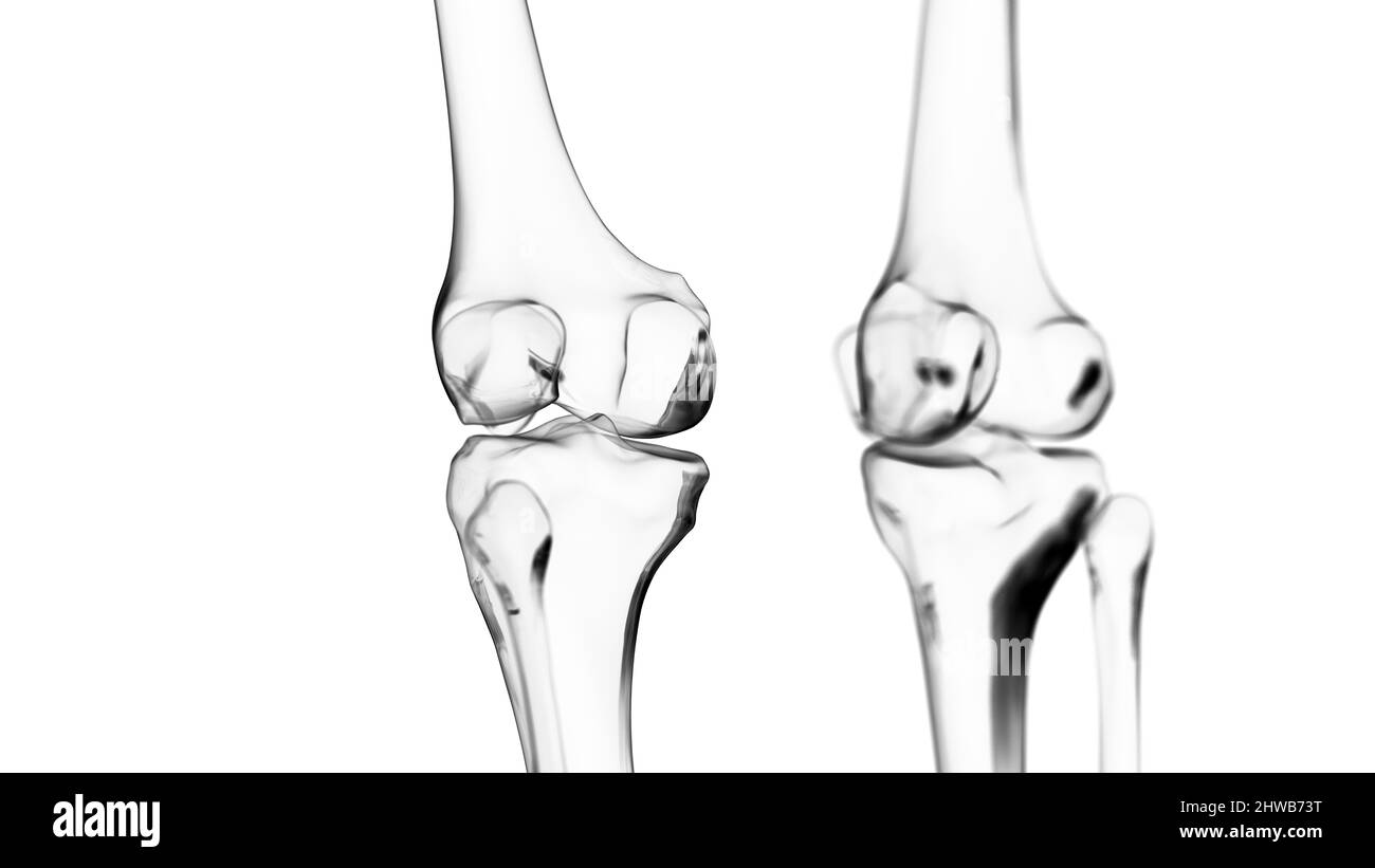 Anatomie du genou Banque d'images noir et blanc - Page 3 - Alamy