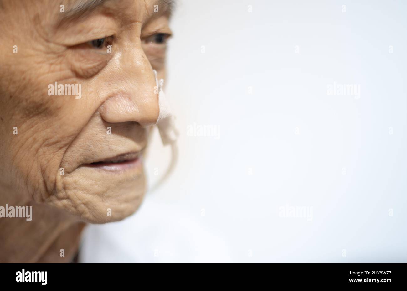 Cancer du nez Banque de photographies et d’images à haute résolution ...