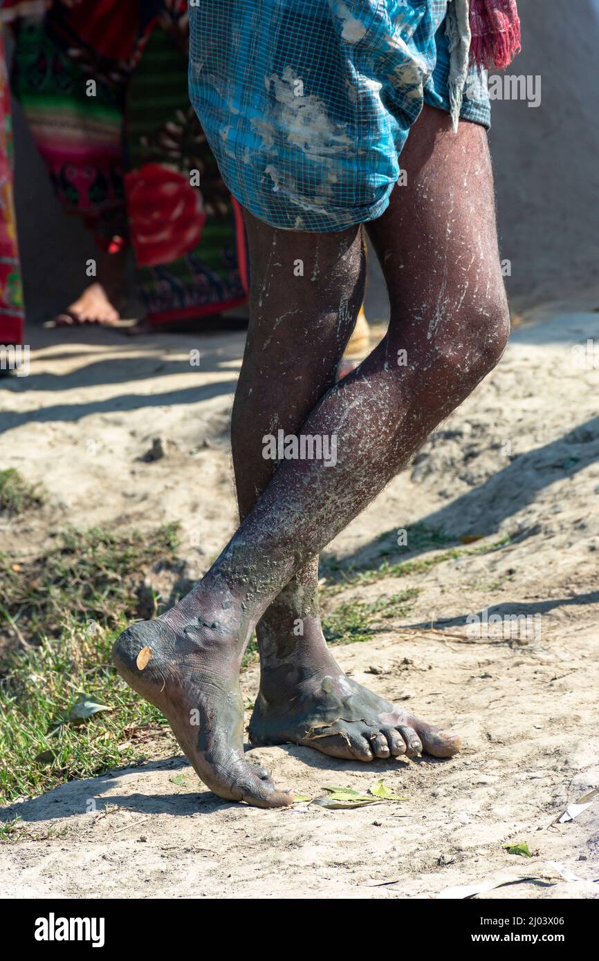 Poisson avec des jambes humaines Banque de photographies et d’images à ...