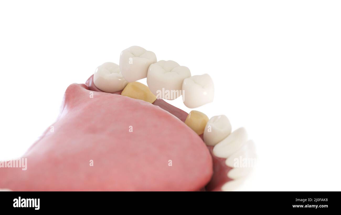 Anatomie dentaire 3d Banque de photographies et d’images à haute ...