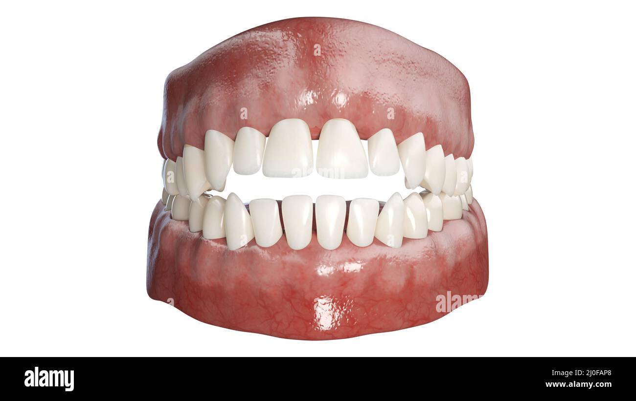 Morsure des dents Banque d'images détourées - Alamy