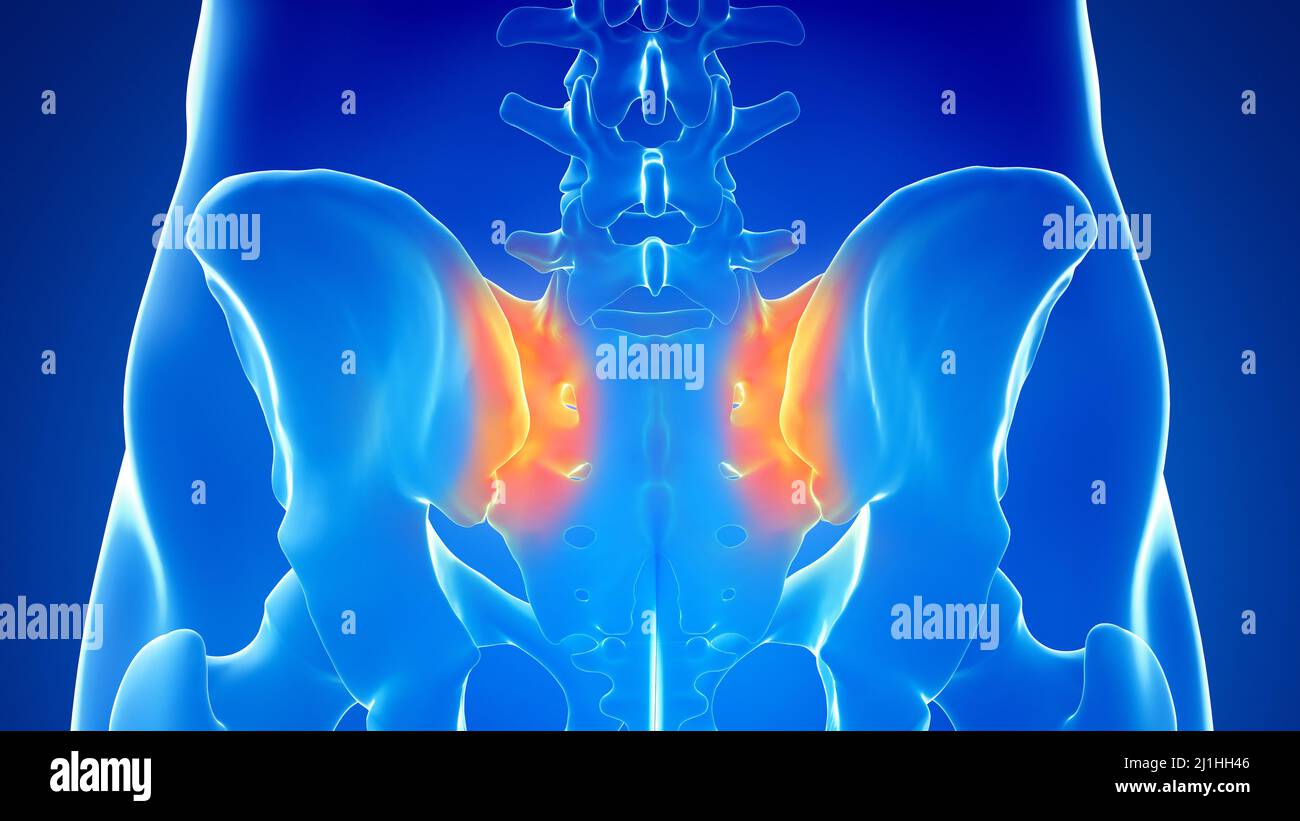 Articulation sacro iliaque douloureuse Banque de photographies et d ...